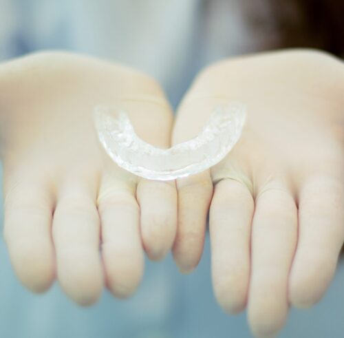 How Much Does a Night Guard Cost? | Bite Guards in Melbourne