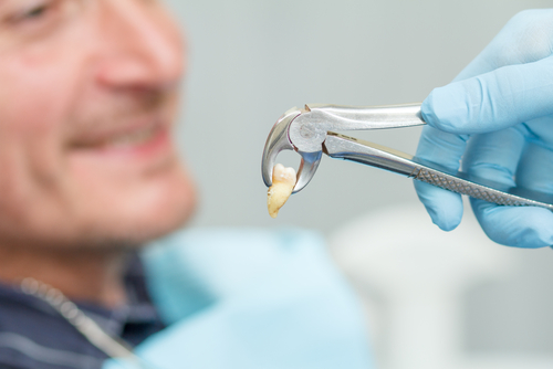 Tooth Extraction Post-Op Instructions | Melbourne, FL | Dr. Apel